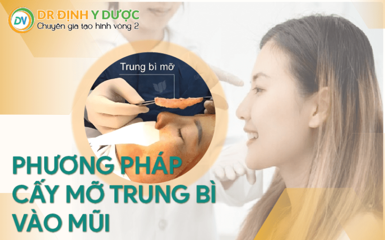 #1 Cấy Mỡ Trung Bì Vào Mũi Là Gì? Ai Được Thực Hiện?